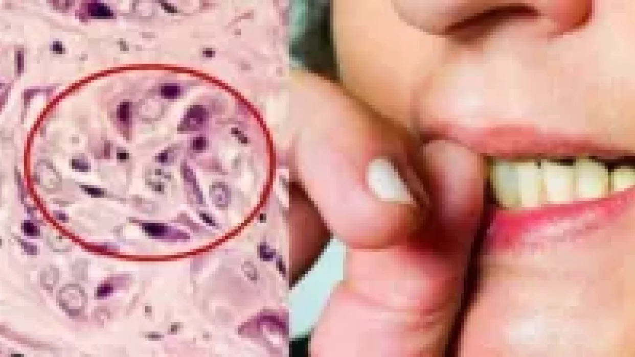 你知道手指甲有多少细菌吗?显微镜放大100倍,看完鸡皮疙瘩一地