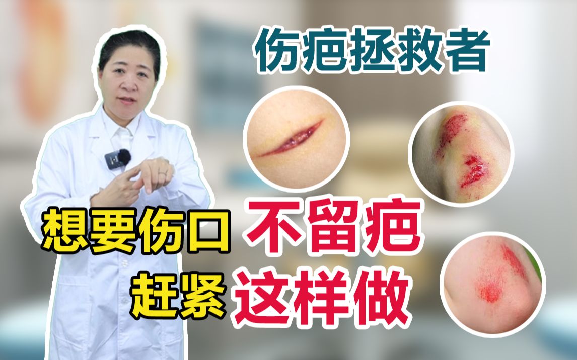 擦伤皮肤后马上要酒精或碘酒消毒?第一步你就做错了!