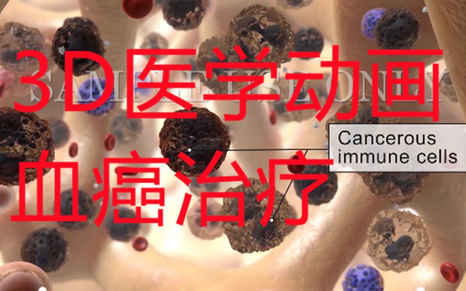 血癌治疗方案-3D医学动画