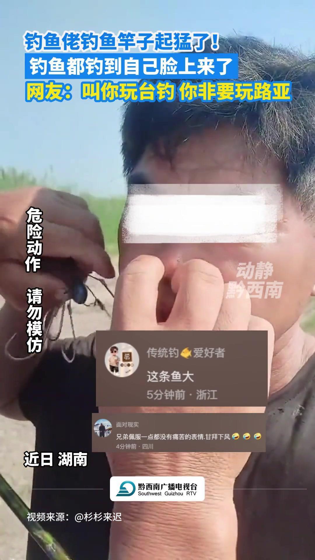 钓鱼佬钓鱼竿子起猛了!钓鱼都钓到自己脸上来了网友:叫你玩台钓你非...