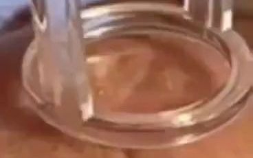 皮肤有疤痕不好看?如何去除疤痕呢?