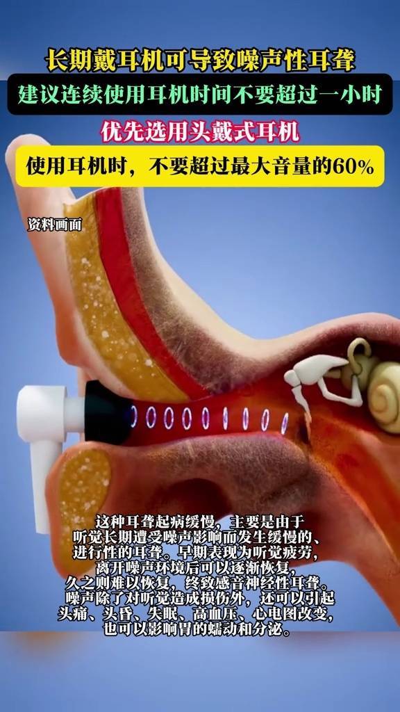长期戴耳机可导致噪声性耳聋,建议连续使用耳机时间不要超过一小时,...