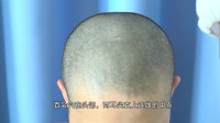 百会穴——人体穴位查找【中推杜辉】