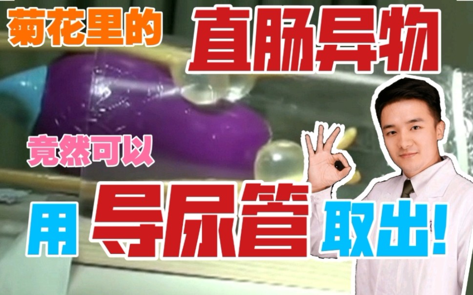 【污!慎入!】卡在菊花里的直肠异物,用导尿管取出?