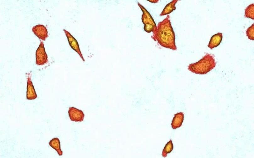 HoloMonitor活细胞分析仪-一款不需要染色和标记的成像仪