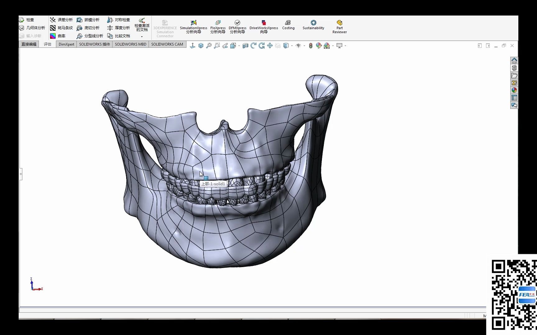 刚做好的口腔正畸模型,还行吧