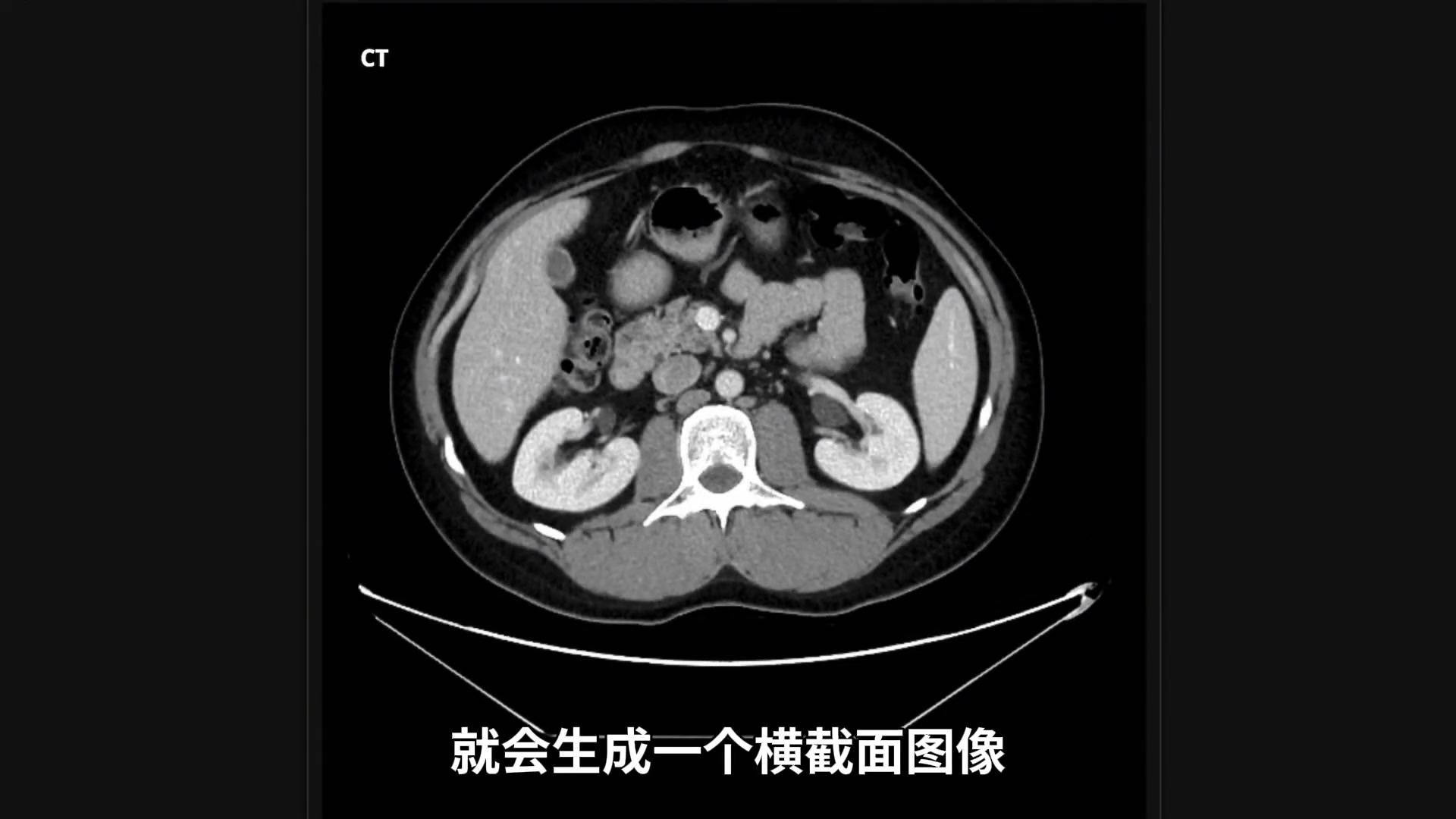 发明CT扫描仪的真是个天才