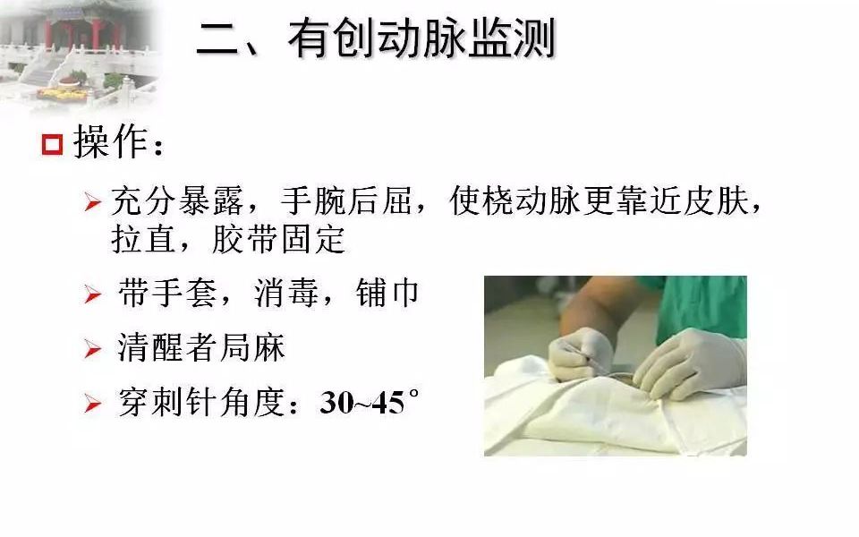 有创血流动力学监测