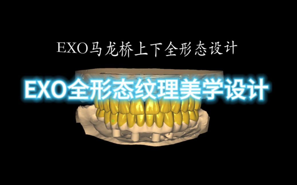 EXOCAD全口马龙桥全形态设计