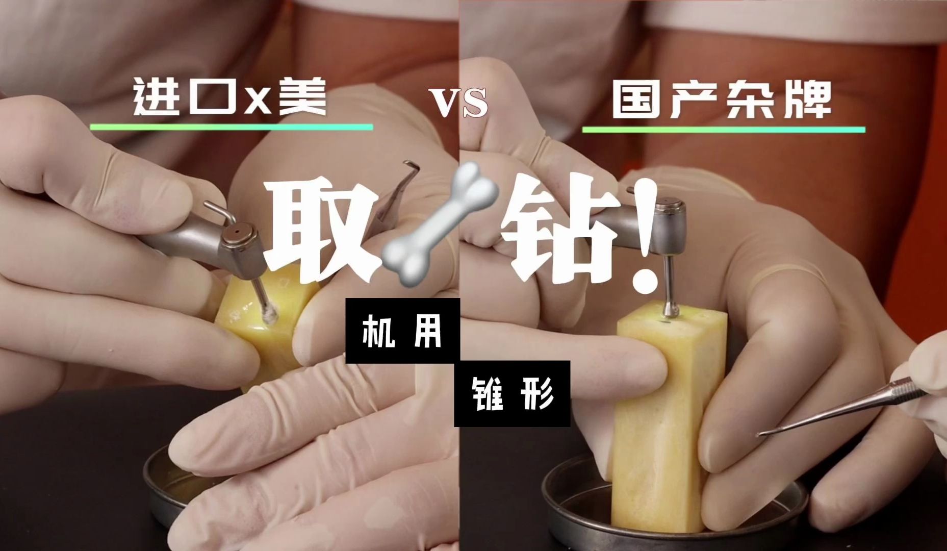 湾区牙医在测评|手动换电动:取骨钻的进口国产之争
