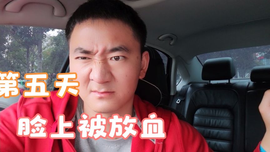 面部神经炎治疗第五天,脸上,脖子上都放血,后背和脚上都扎针