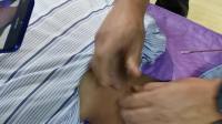 奇针疗法哑门穴李莉15321056690