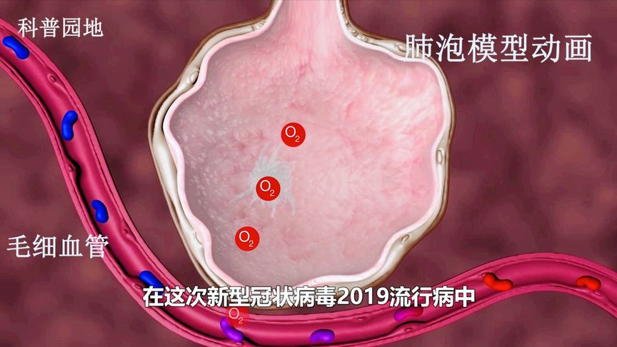 新型冠状病毒是如何攻击肺泡的呢?病毒又是如何繁殖后代?