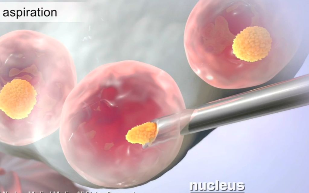 【3D演示】试管婴儿(原版+字幕版)