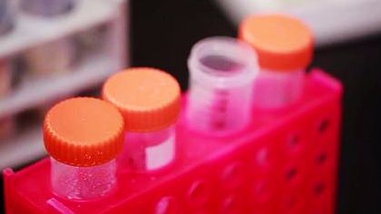 女博士自建实验室检测食品安全,结果让她连说:想不到!