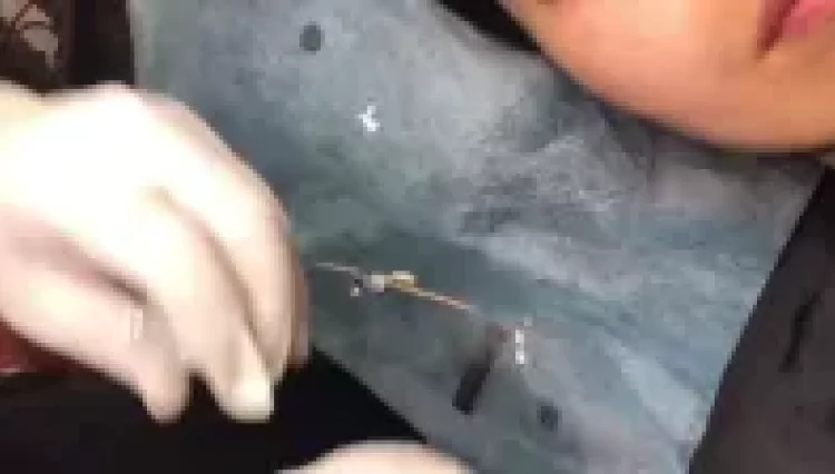 《寡肽原液正确用法》