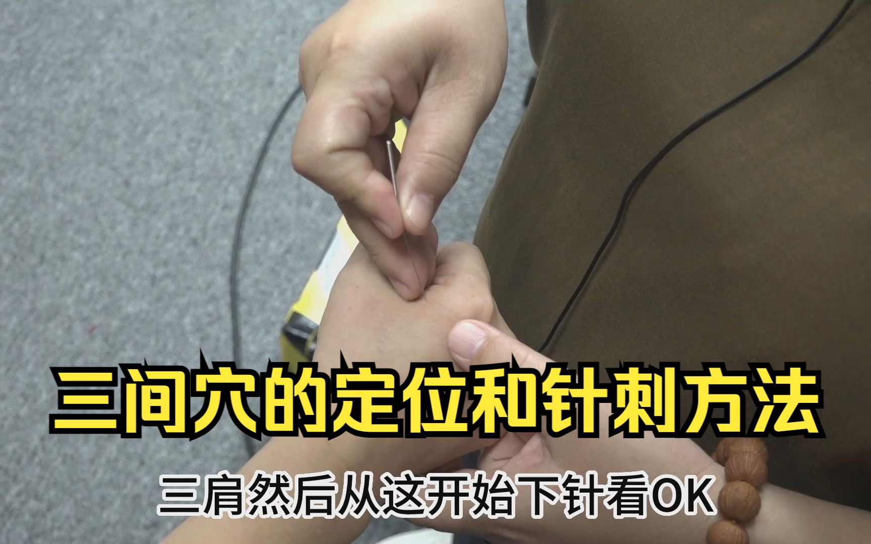 刘红云:三间穴的定位和针刺方法