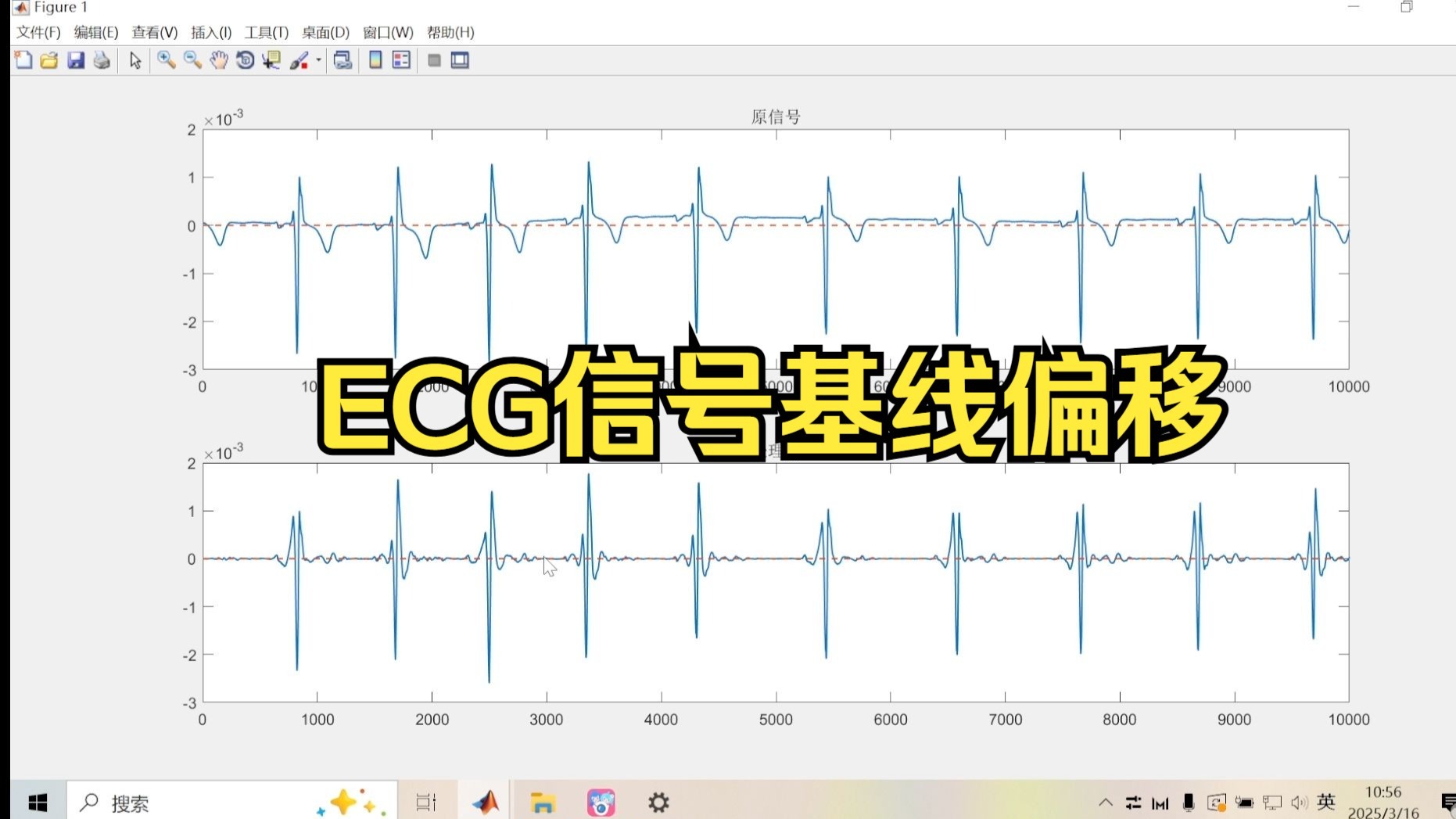 处理ECG信号基线偏移