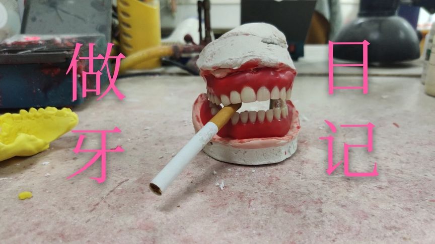活动假牙快速制作,原来牙齿也有这么简单!