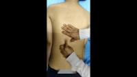 李老师 五运六气 脾俞穴 腹胀、腹泻