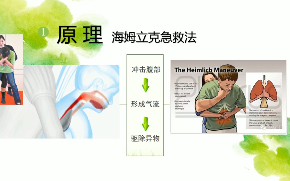 海姆立克急救法的渊源与原理