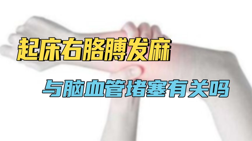 睡觉醒来,右胳膊总感觉发麻,这与脑血管堵塞有关?
