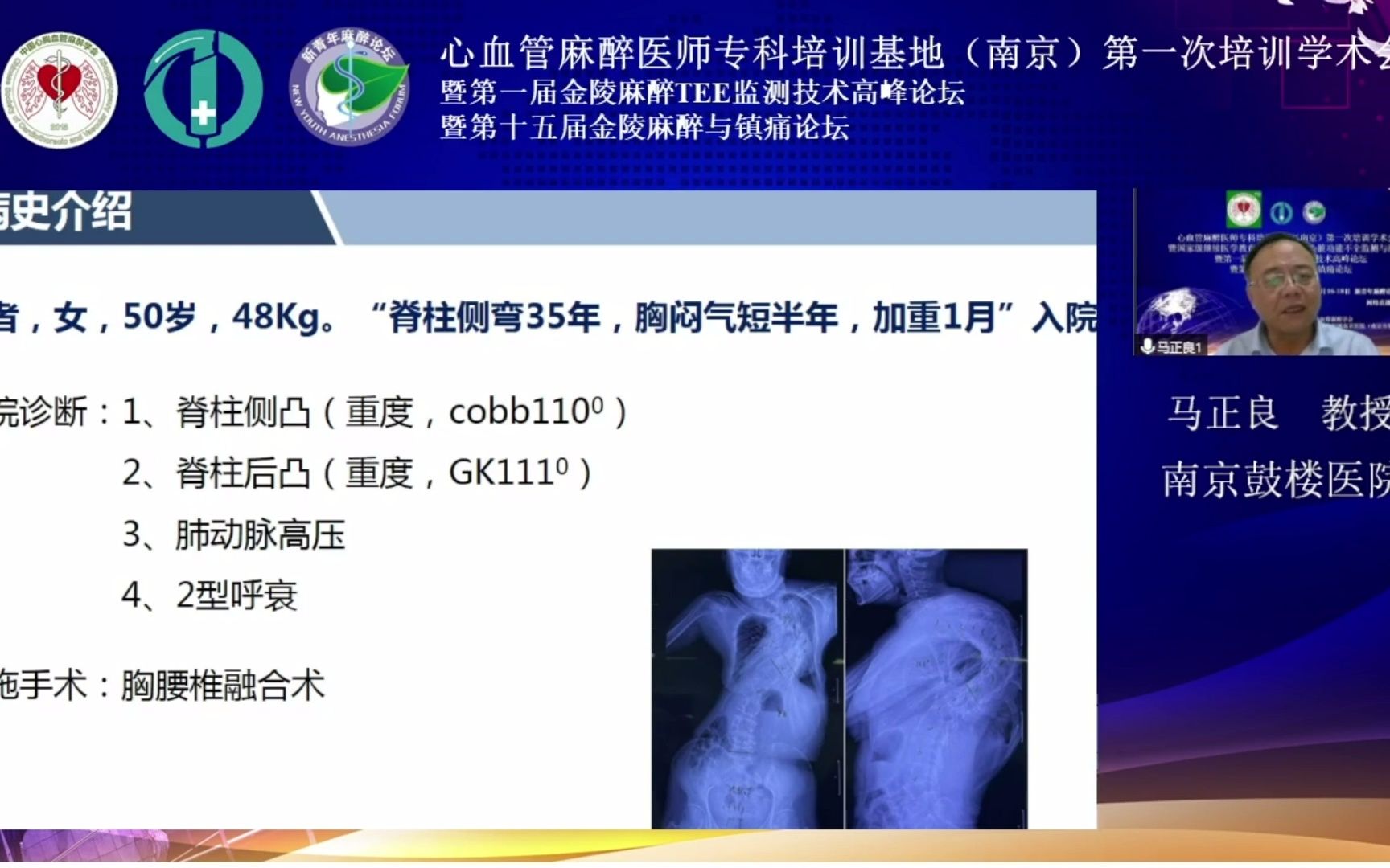 合并肺动脉高压患者非心脏手术的麻醉与围术期管理-马正良教授