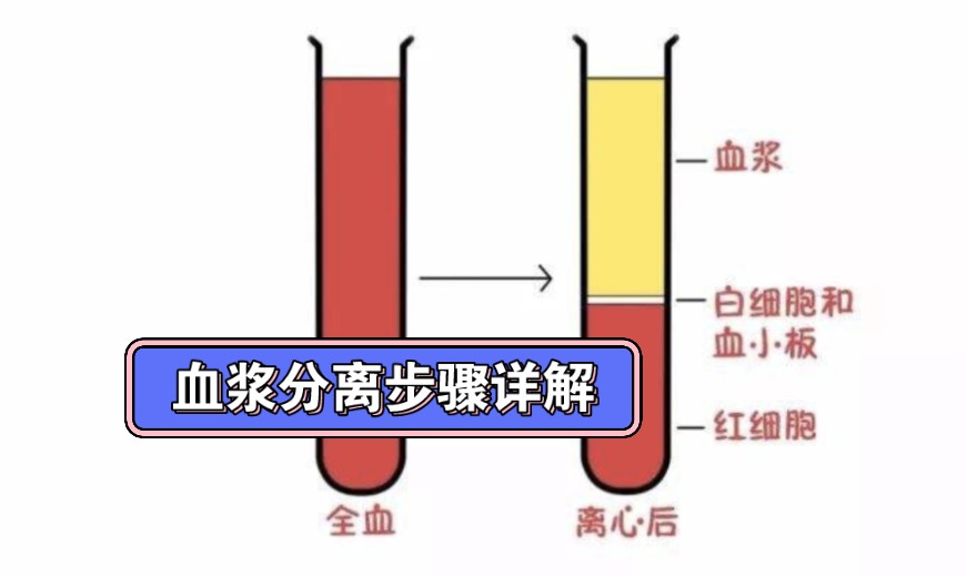 一、血浆分离步骤详解