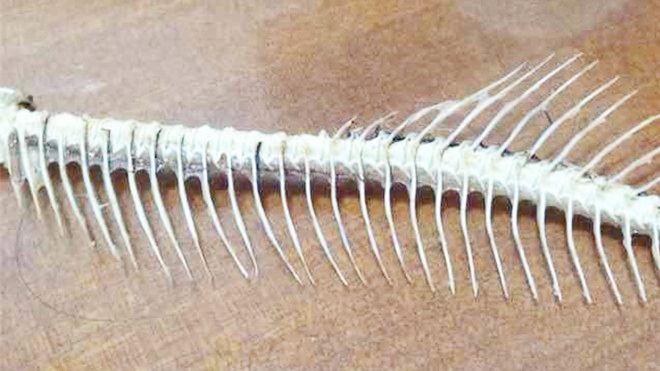 鱼刺卡喉咙时,不要着急喝醋,一个小方法,轻松解决