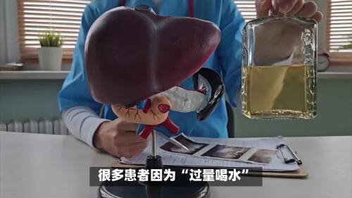 肝硬化饮水过量很危险!出现这三个信号必须立刻停止