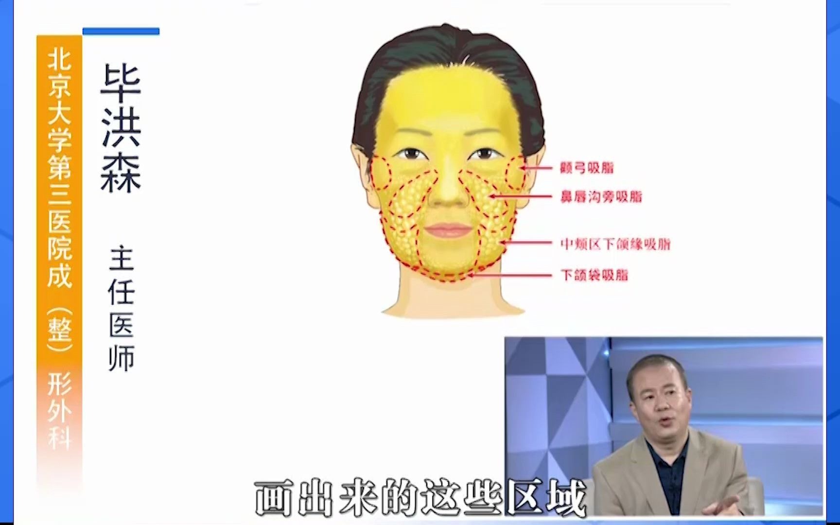 面部多余脂肪“搬个家”,减龄效果明显又持久