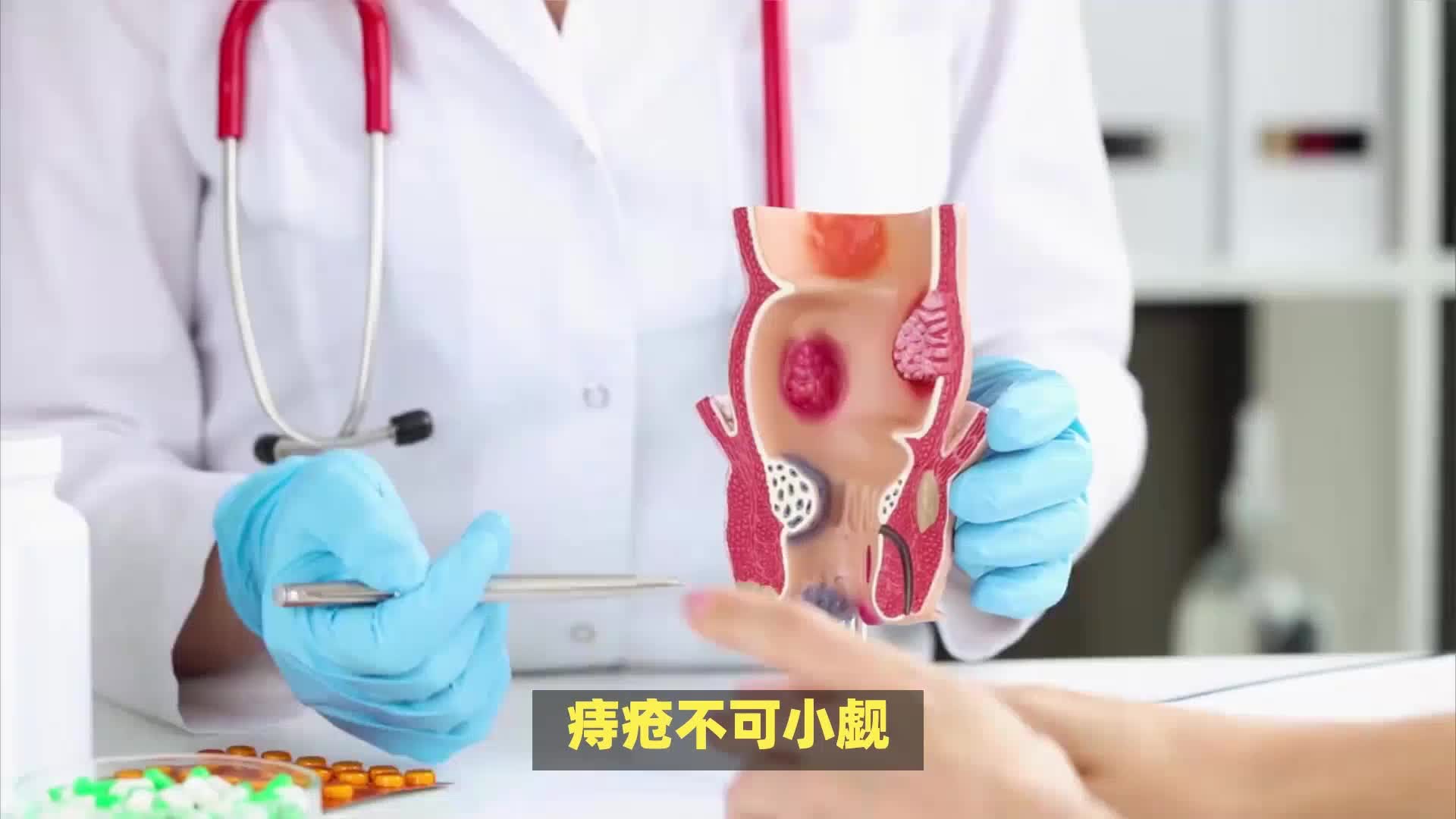 痔疮初期症状是什么样?教你认出这5个表现别再蒙在鼓里!