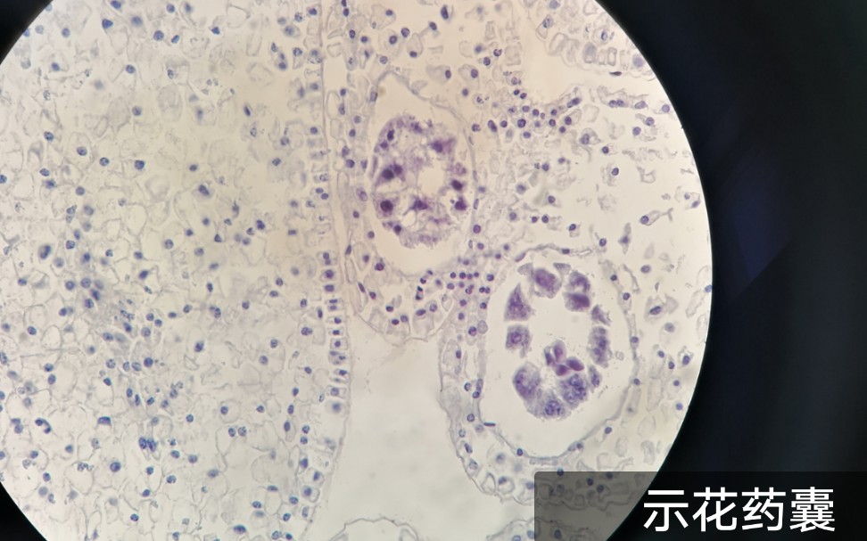 石蜡切片包埋-王老师上课时学生随手拍