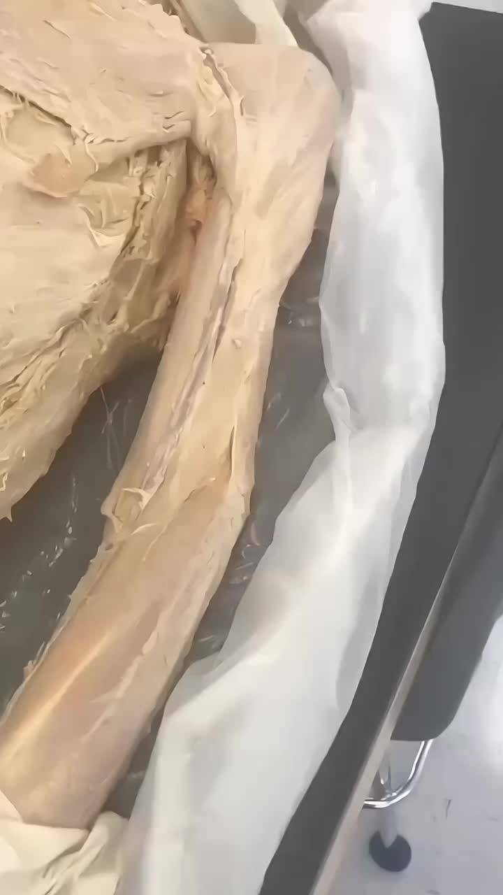 如何区分静脉和动脉