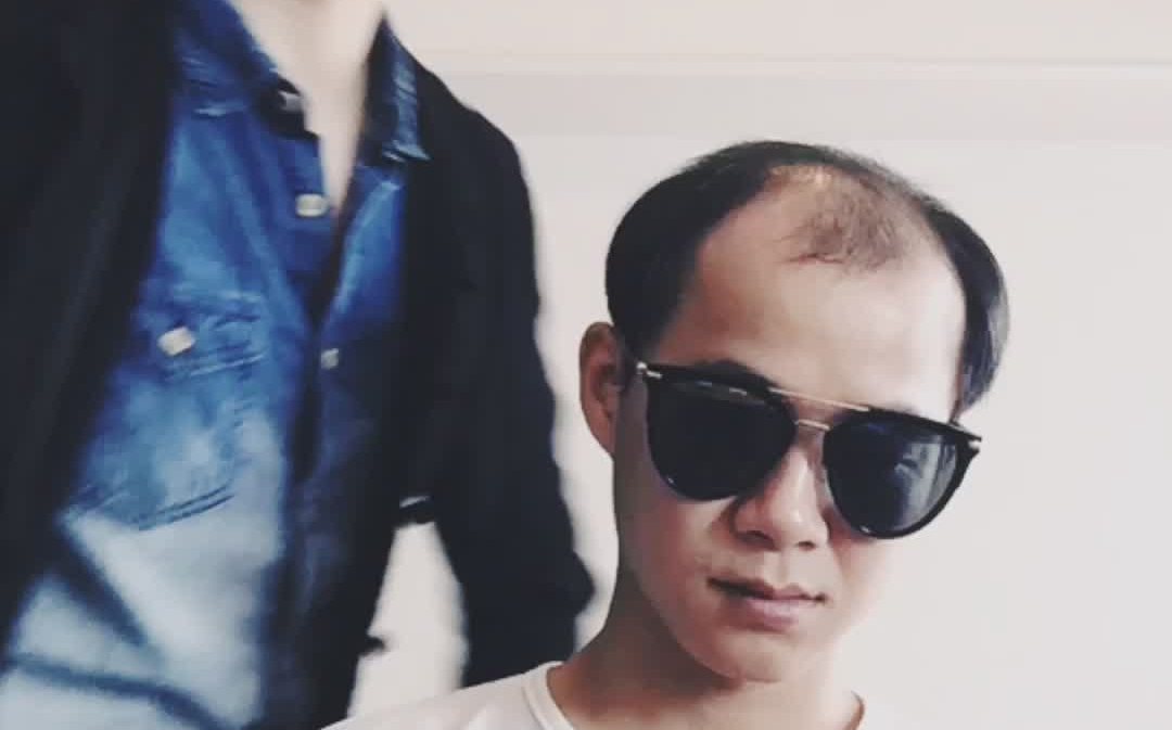 脱发严重怎么办?吃什么增发生发?