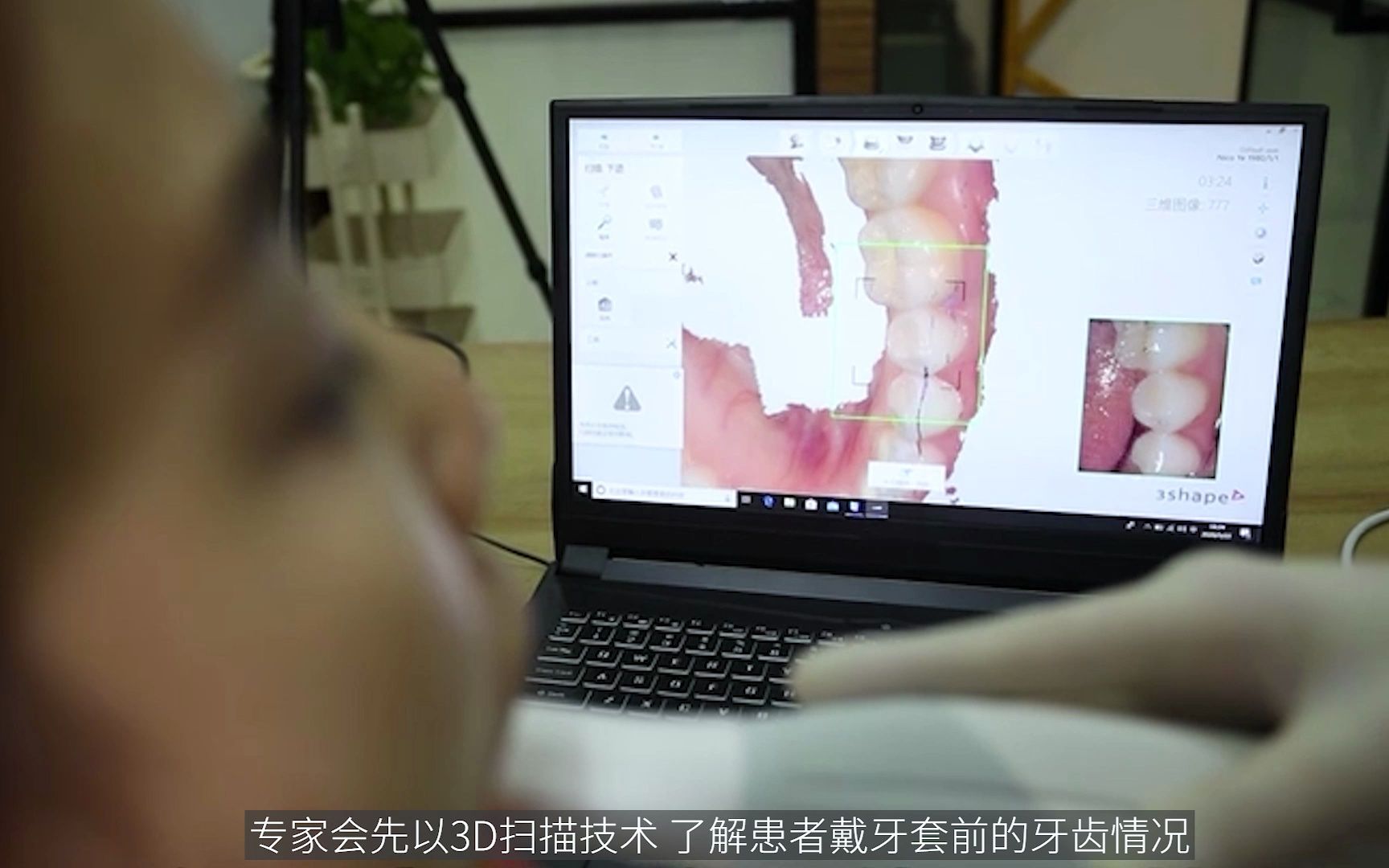 哈工三维齿科3D打印机R3pro制作牙模和隐形牙套全过程介绍