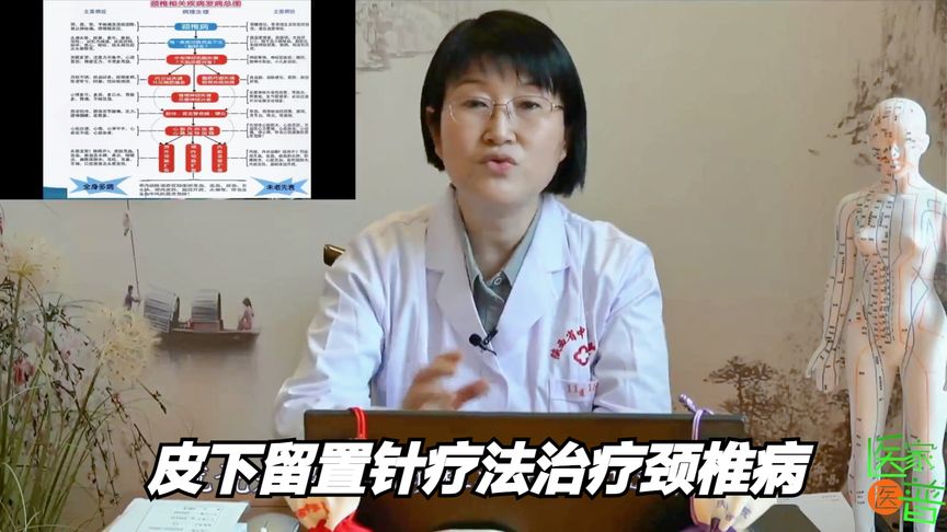 皮下留置针疗法治疗颈椎病系列三