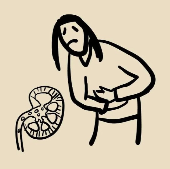 阳光君说结石 