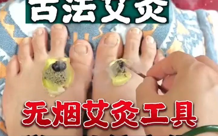 古法艾灸,自己在家里也能手工制作出无烟艾灸工具