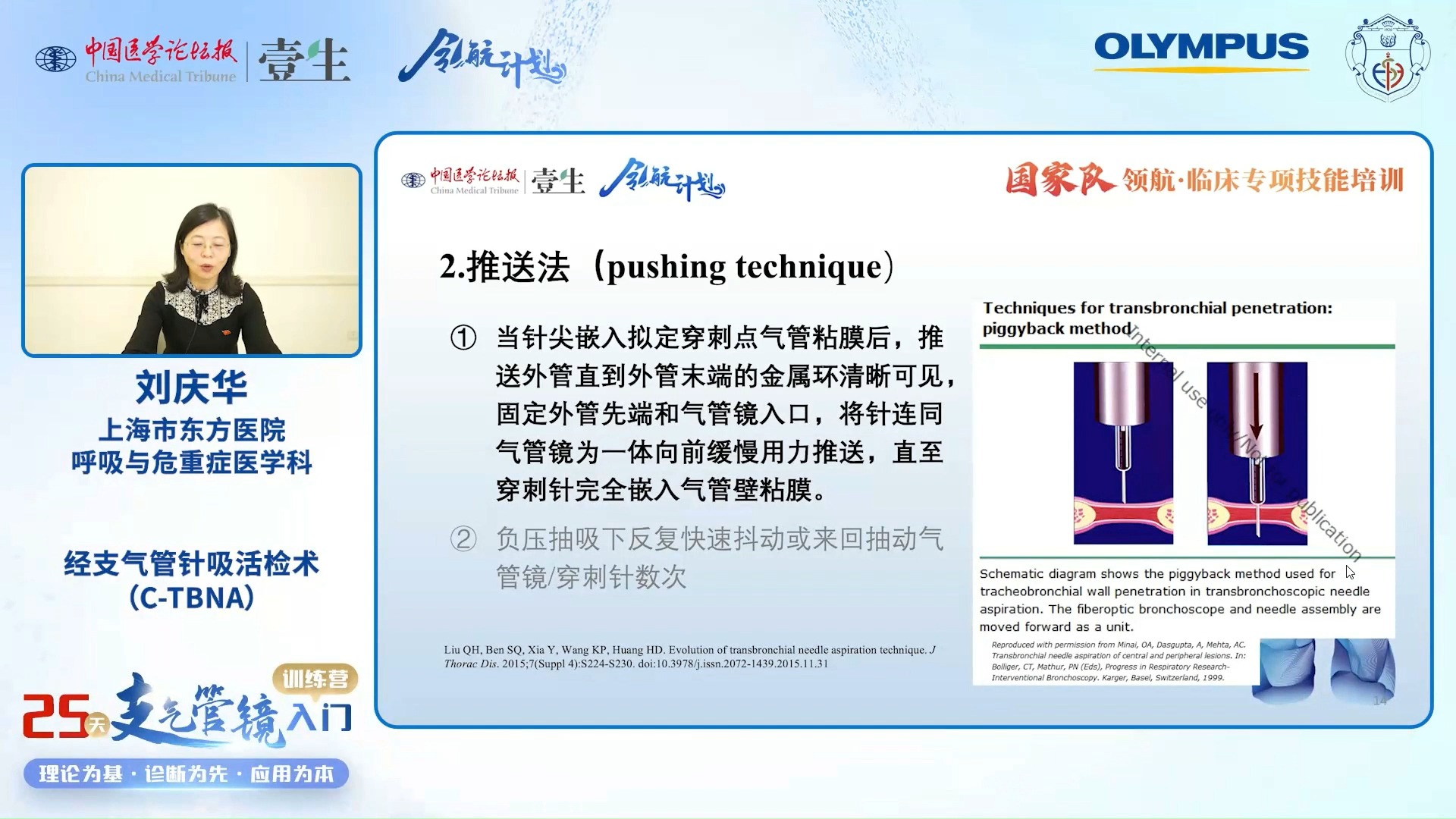 经支气管针吸活检术(C-TBNA)