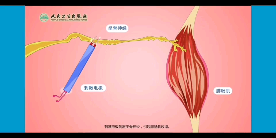 【生理学】坐骨神经-腓肠肌电刺激收缩原理