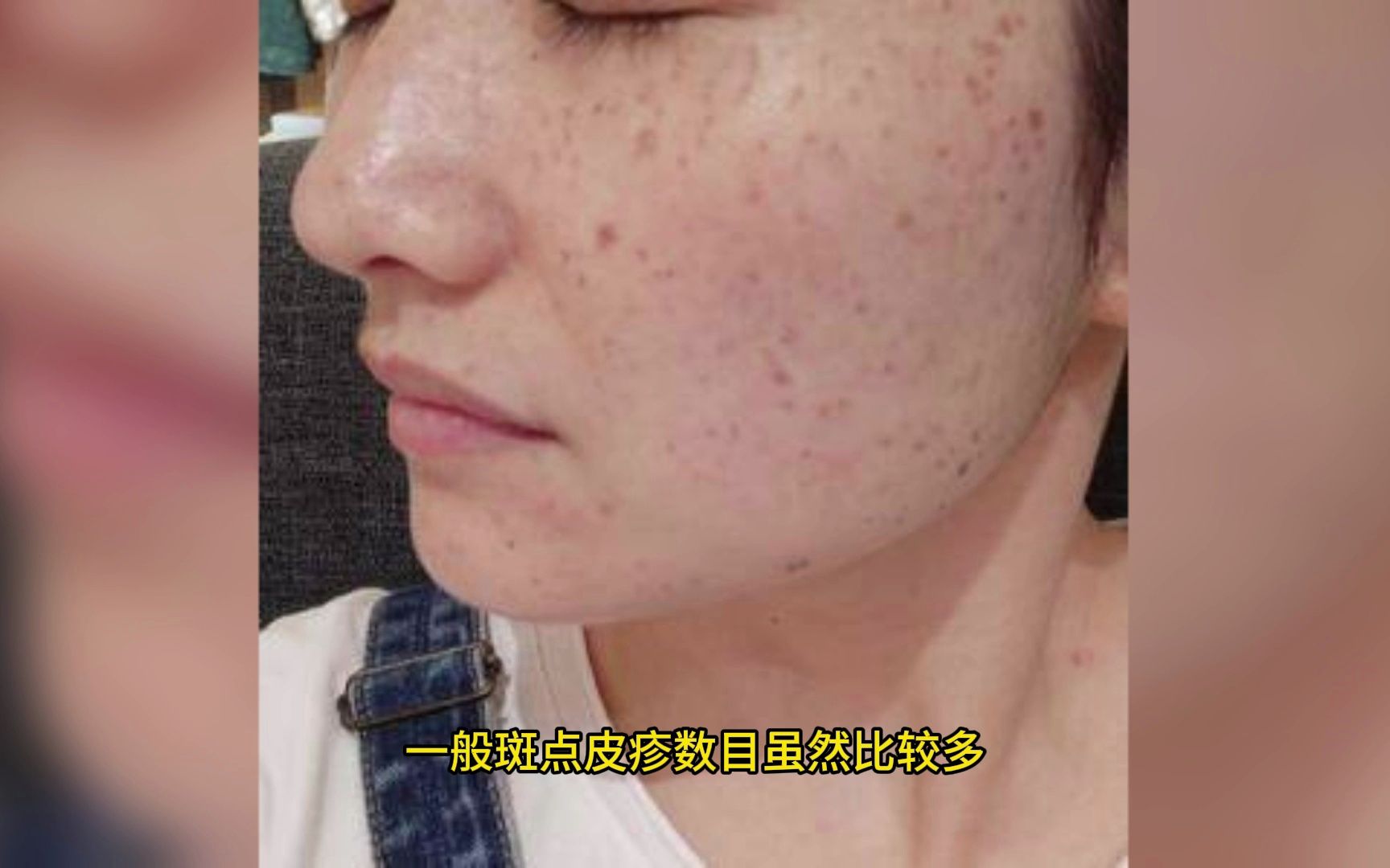 超皮秒多久才能看到效果~