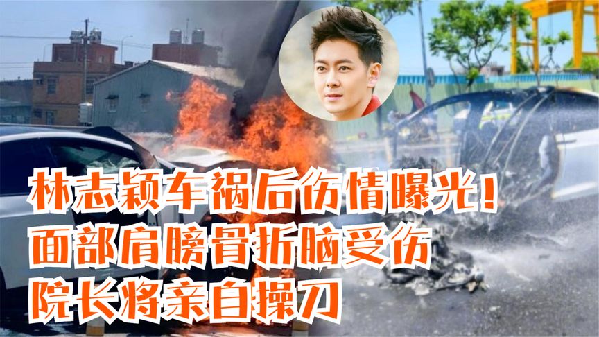 林志颖车祸后伤情曝光!面部肩膀骨折脑受伤,院长将亲自操刀