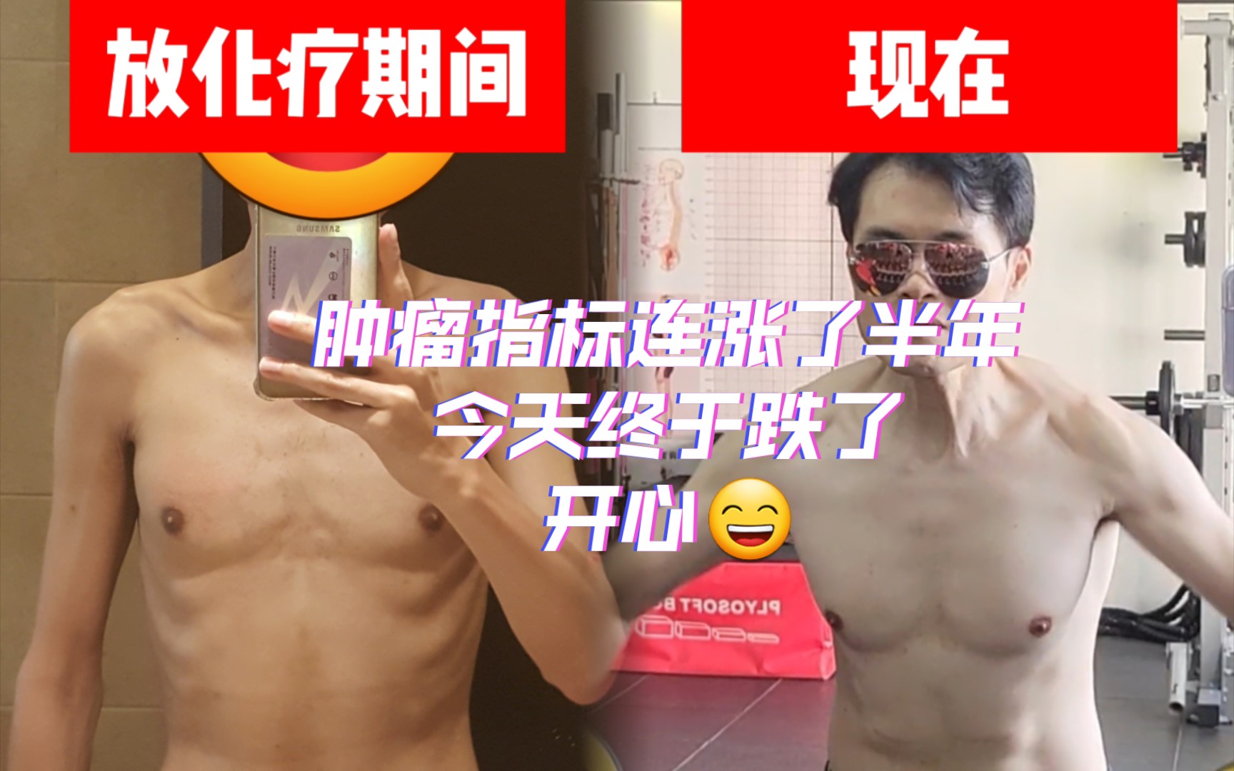 可怕的EB病毒,居然自己会减少,这算不算奇迹啊?
