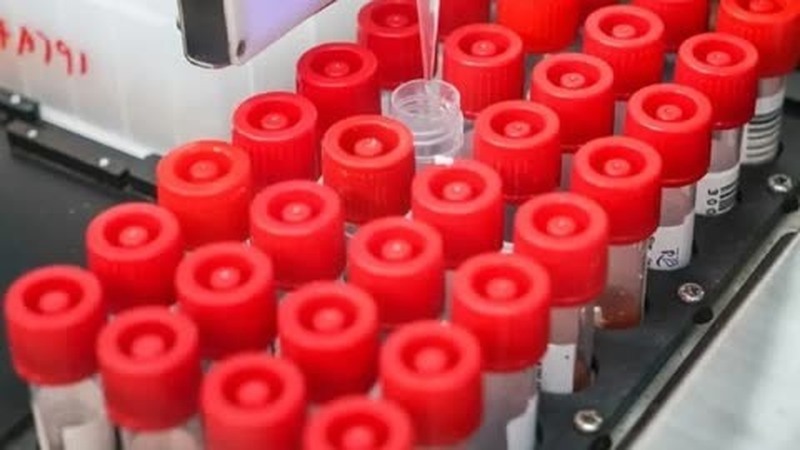 国家卫健委:新冠病毒培养应在生物安全三级及以上实验室开展