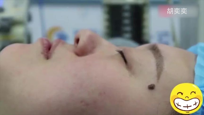 花10万块隆鼻,术后整成高级脸,闺蜜都说我鼻子整的很好看