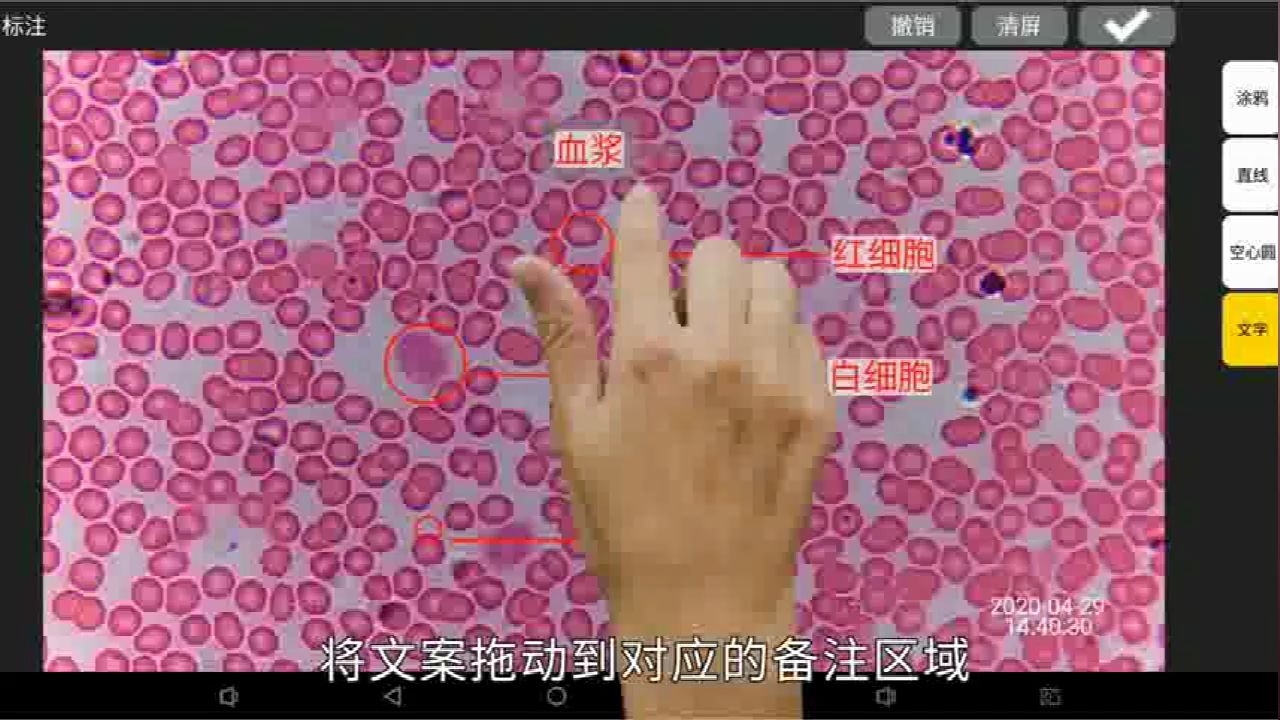 利用数码显微镜观察血液细胞