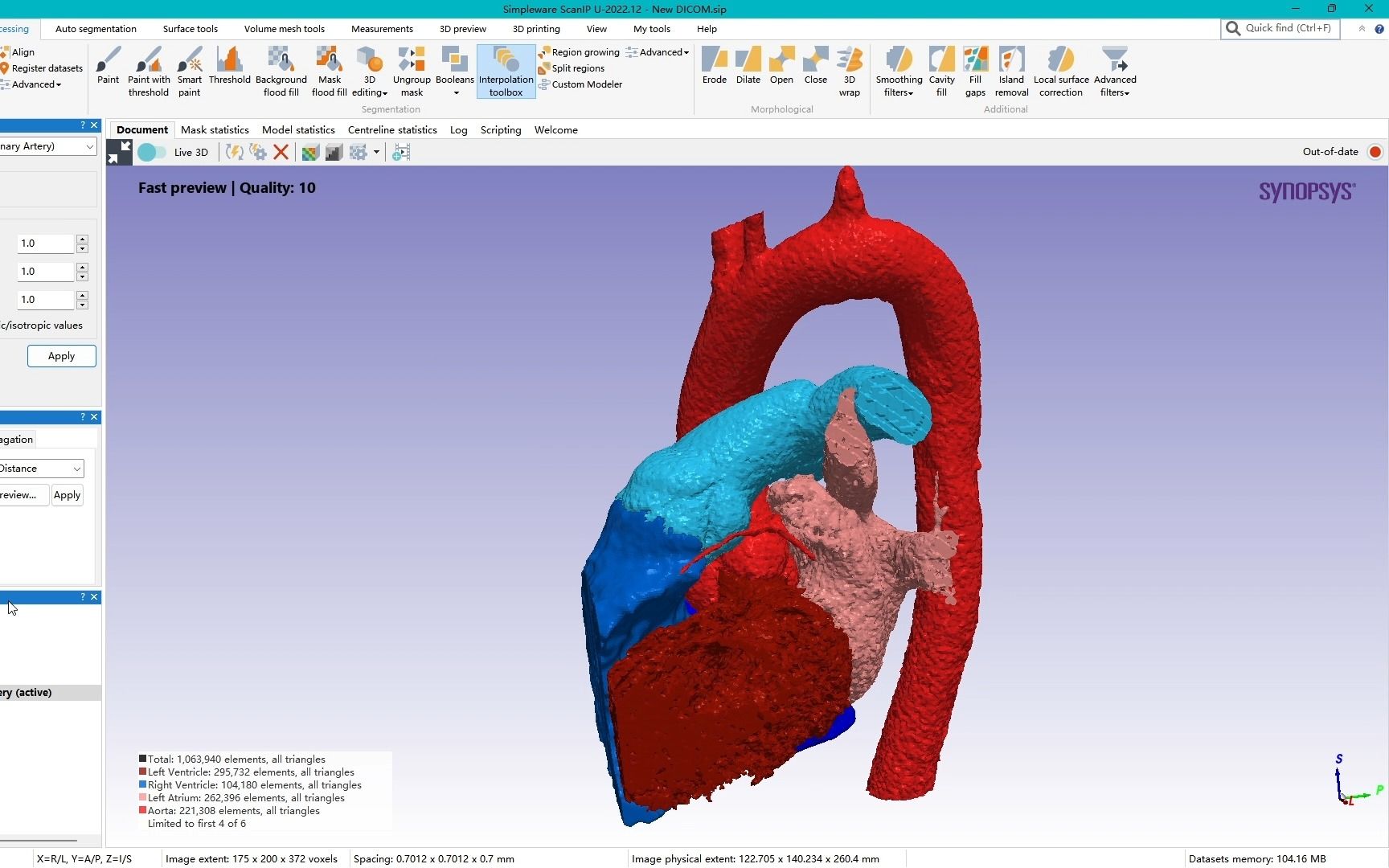【Simpleware】教程:心脏图像数据的分割