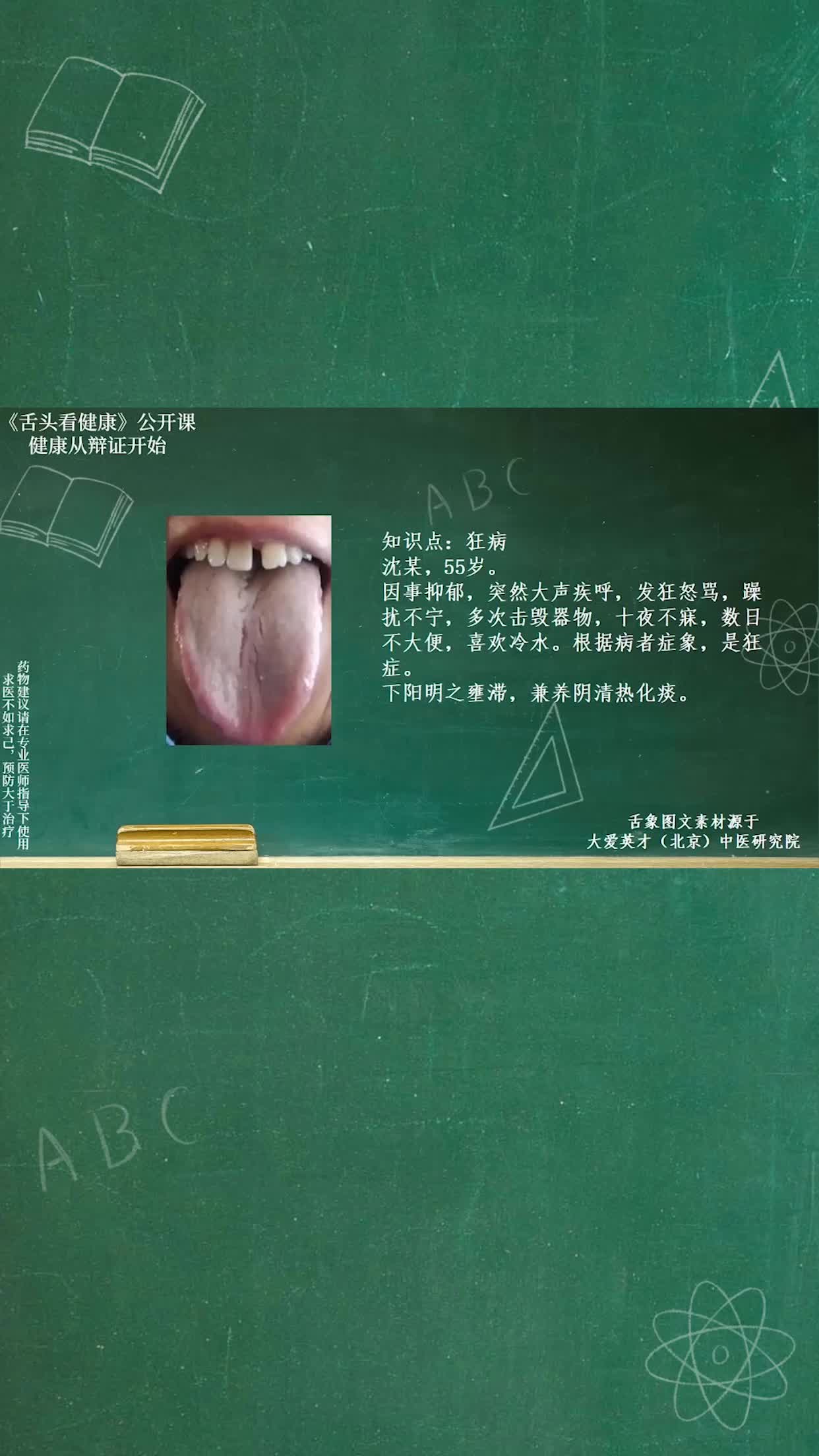 长期焦虑,抑郁导致出现失眠,便秘,狂躁症的舌象讲解