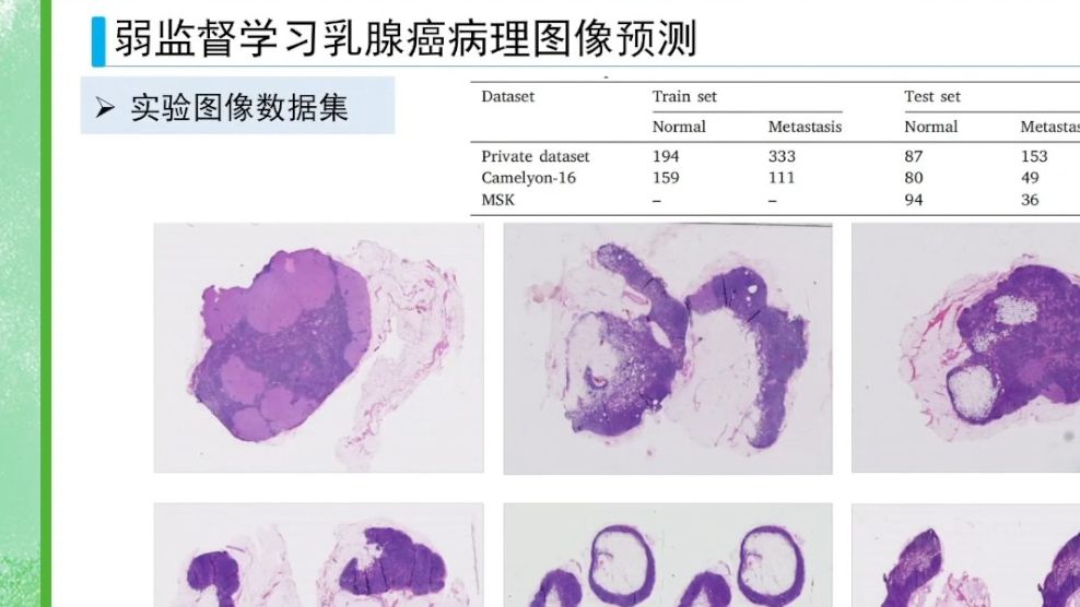 20240130-大连民族大学张建新-基于深度学习的乳腺癌病理图像分析
